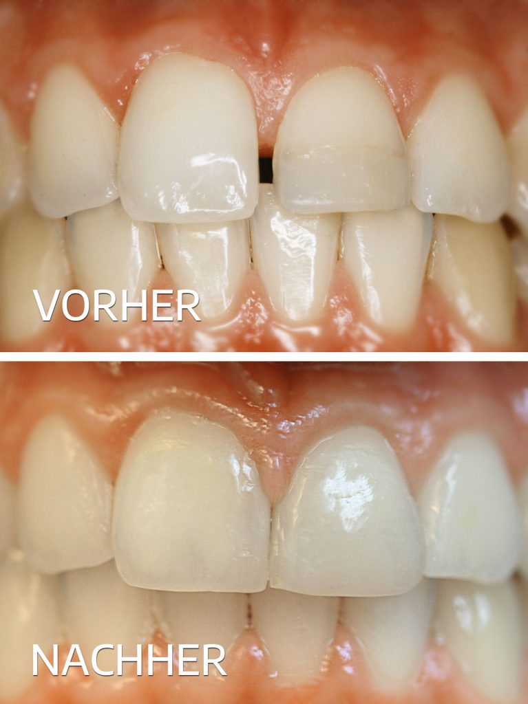 Ästhetische Zahnmedizin - Zahnärztin Dr. Julia Tomalla